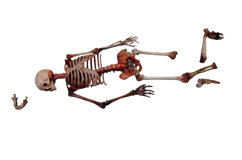Dismembered Bloody Skeleton Prop – Dapper Cadaver Props