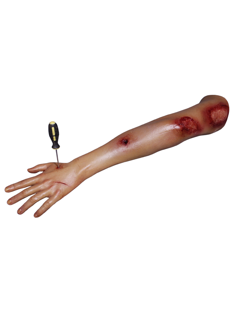 Types of Wounds Dura Yong Arm – Dapper Cadaver Props