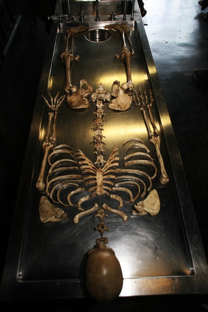 Disarticulated Skeleton with Cast Skull – Dapper Cadaver Props